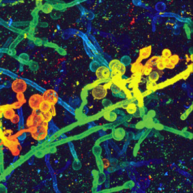 Dr. David Relman: «The stability of the human microbiome»; MWV51 ...