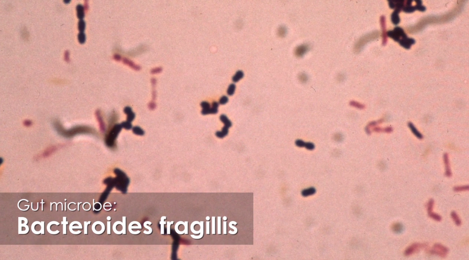Dr. Rob Knight: “The Microbiome Project”; MWV82 (Noticias ...